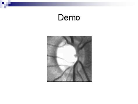 Active Contours Technique In Retinal Image Identification Of