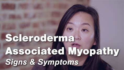 Scleroderma Associated Myopathy Archives Johns Hopkins Myositis Center