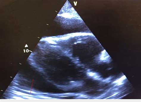 Transthoracic Echocardiography Download Scientific Diagram