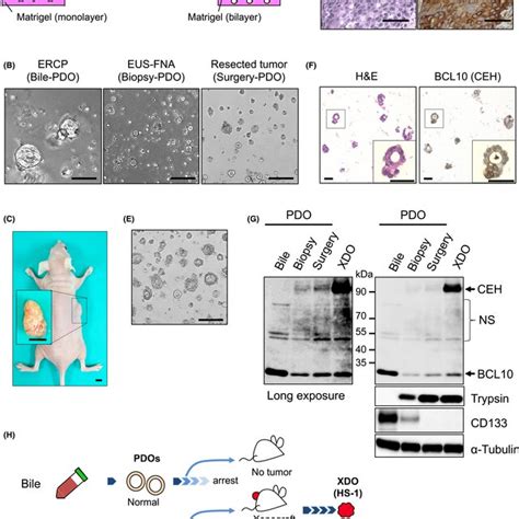 Propagation Of Patient‐derived Organoids Pdos And Development Of A