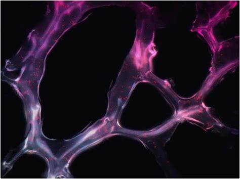 Spatial Transcriptomics In Cancer Research And Diagnostics