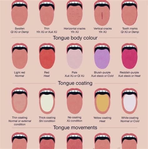 Tongue Diagnosis A Chart Diagnosis Reference Chart T Vrogue Co