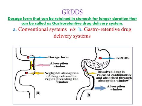 Gastroretentive Drug Delivery System By Mali Vv Pptx