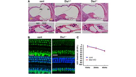 No Hc Loss Or Hearing Loss In Dia1 Ko Mice Cochleae From Control