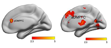 Limbic Interactions Of The Dorsal Medial Prefrontal Cortex The Other Lobe Of The Brain