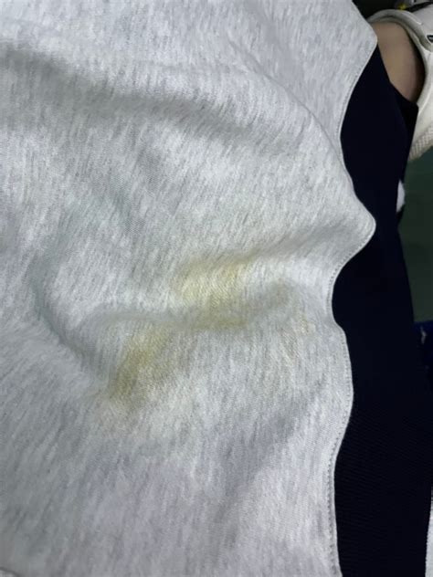 옷 뒤 노란색 묻음 지식in