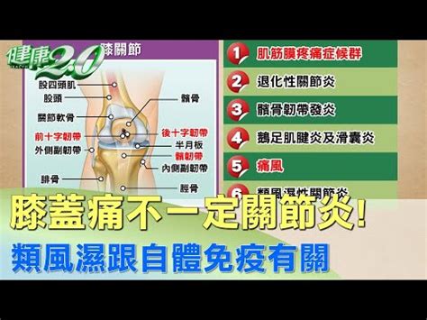 膝蓋痛不一定關節炎類風濕跟自體免疫有關 健康2 0 YouTube
