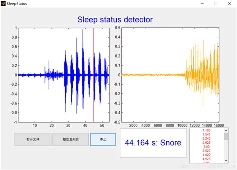 【脑电信号】基于matlab hmm睡眠状态检测【含matlab源码 050期】 sleep analysis matlab csdn博客