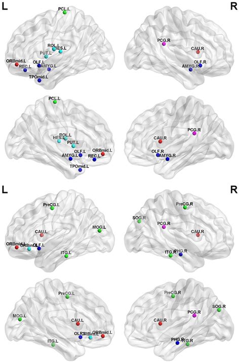 Hubs Of The Functional Brain Networks In Each Group The Results Were Download Scientific