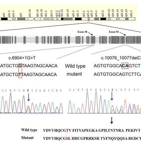 Minigene Splicing Assay In Hek 293 Cells A Schematic Representation