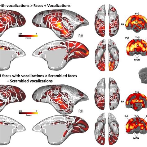 Superadditive Neural Processing Of Multisensory Face And Vocal Signals Download Scientific