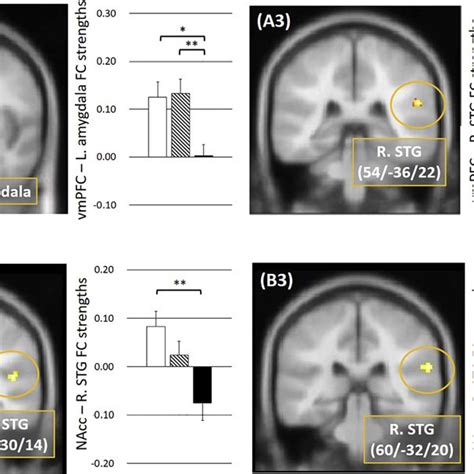 Seed Based Resting State Functional Connectivity Rsfc And The Download Scientific Diagram