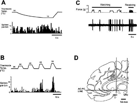 Microelectrode Recordings In The Cingulate Gyrus And The Anterior Thalamus Neupsy Key