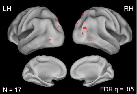 Whole Brain Analysis Examining Activity Elicited For Scenes In Window