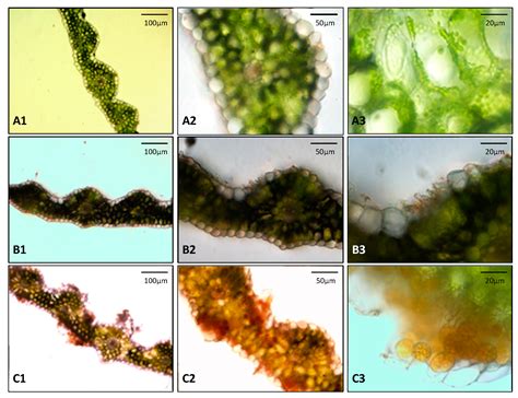 Early Visual Detection Of Wheat Stripe Rust Using Visiblenear Infrared