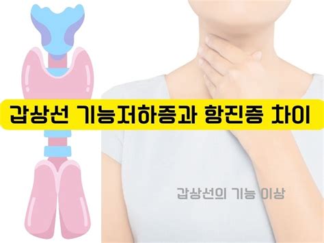 갑상선 기능 저하증과 항진증의 증상 차이 치료법