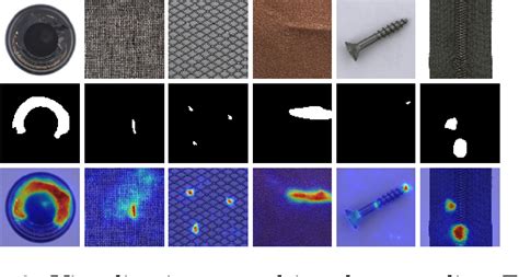 Figure 1 From Mixed Distillation For Unsupervised Anomaly Detection Semantic Scholar