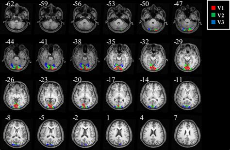 A Typical Volunteer S Lower Visual Cortex V1 V2 And V3 Spatial Download Scientific Diagram