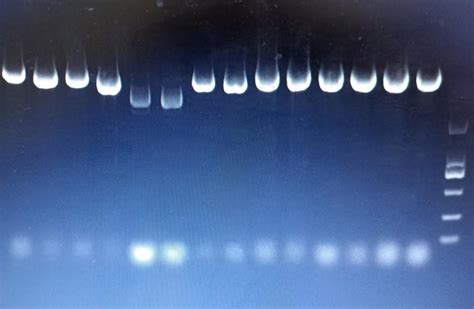 After Doing Endotoxin Free Extraction Of Plasmids I Am Getting A Less