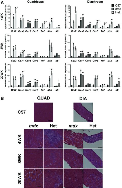Temporal Gene Expression And Histology Comparing Dystrophic Mouse Download Scientific Diagram