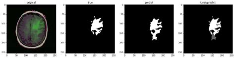 GitHub KurisuZhang CNN For Brain Lesion Segmentation In MRI Images In This Work Four Popular