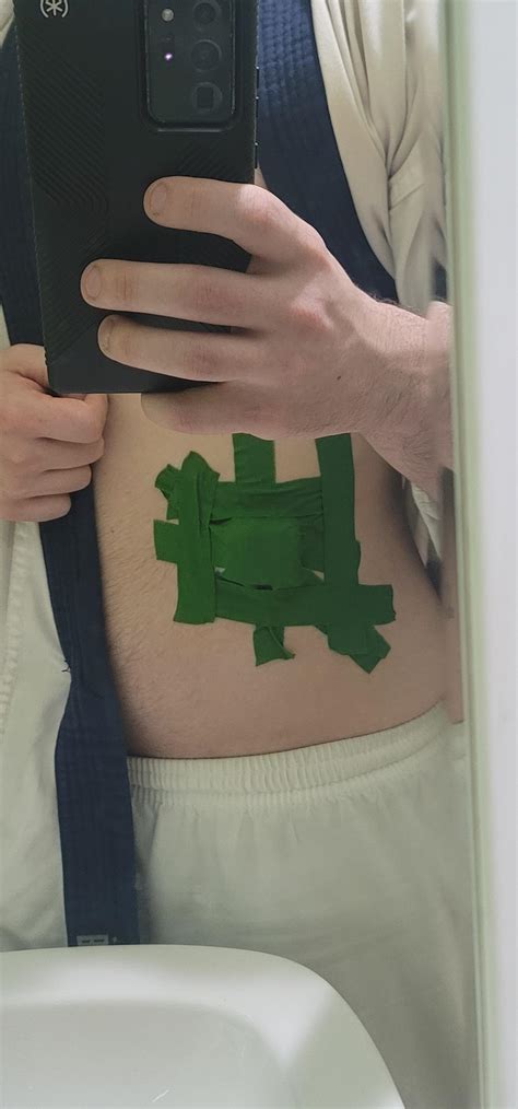 Anything To Stop The Omnipod Adhesive From Falling Off R Diabetes