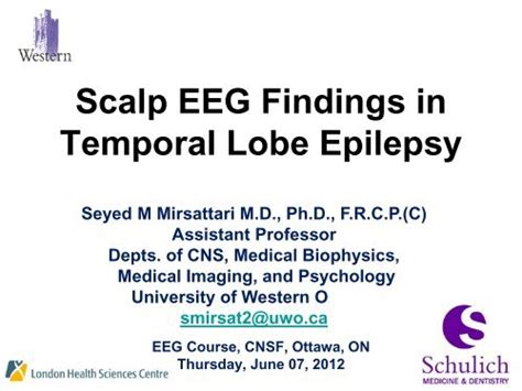 Scalp EEG Findings In Temporal Lobe Epilepsy