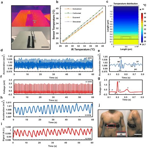 Thermal Characterization Of Temperature Sensor Embedded Fabric The