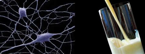 How Does Parity Affect Somatic Cell Count Of A Cow Scct