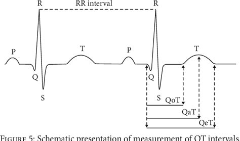 Pdf Hypercalcemia Induced St Segment Elevation Mimicking Acute Myocardial Injury A Case Pdf Hypercalcemia Induced St Segment Elevation Mimicking Acute Myocardial Injury A Case