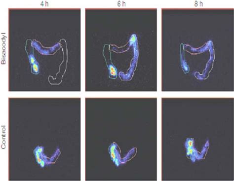 METHODS FOR THE ASSESSMENT OF SMALL BOWEL AND COLONIC TRANSIT PMC