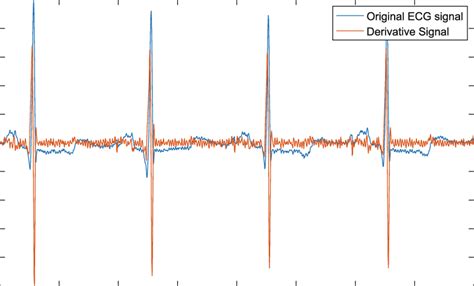 Original Ecg And Derivative Signal Normalized Download Scientific Diagram