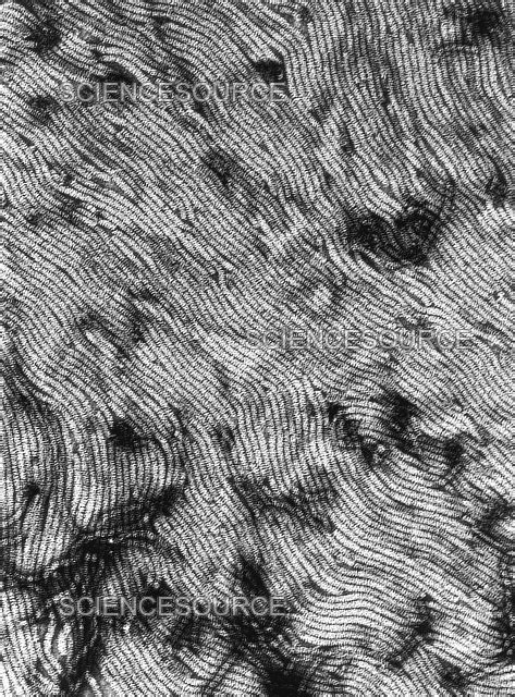 potato virus x stock image science source images