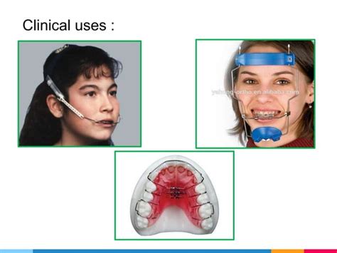 Growth Of Maxilla Pptx