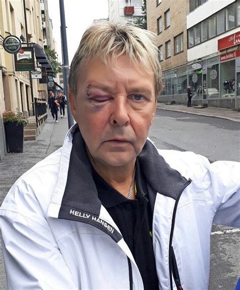 Näin Matti Nykänen Meni Tampereella Tajuttomaksi Ja Sai Mustan Silmän Hurjat Kuvat En Minä