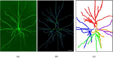 pyramidal neurons