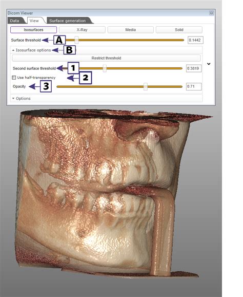 Exocad Wiki File RegistrazioneModelliExocadIta Exocad