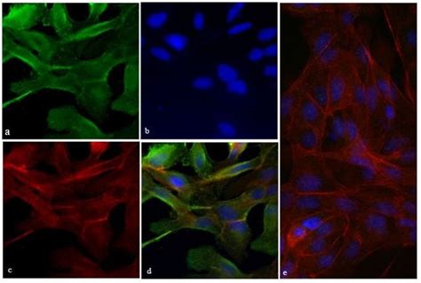 Vinculin Recombinant Monoclonal Antibody 42h89l44 700062