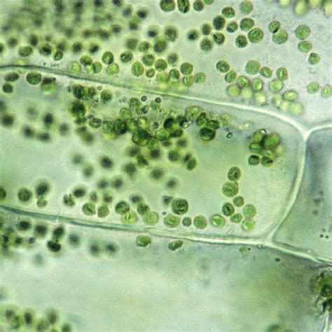 Nucleus In Plant Cell Under Microscope Cell Nucleus Function Structure And Under A Microscope