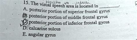 15 The Visual Speech Area Is Located In A Posterior Portion Of