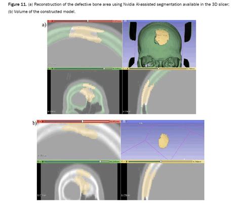 Developing Computational Models To Design 3d Printed Scaffolds Using Ct