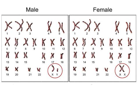 Xy Chromosome Male
