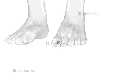 Distal Phalanx Of Left Big Toe Biodigital Anatomy