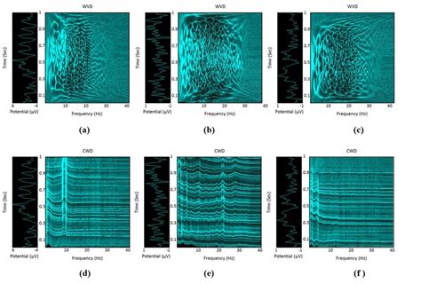 Illustration Of The Constructed Time Frequency Representation Of EEG Download Scientific