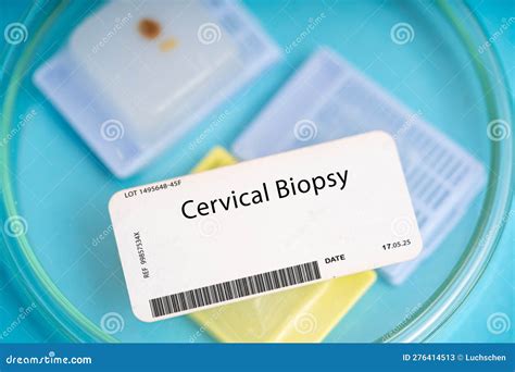 Cervical Biopsy Stock Image Image Of Test Cancer Tissue 276414513