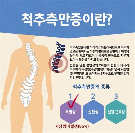 척추측만증 예방 및 개선을 위한 운동법