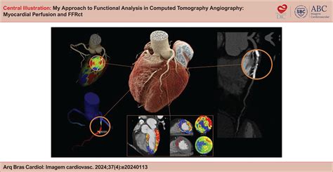 My Approach To Functional Analysis In Computed Tomography Angiography Myocardial Perfusion And