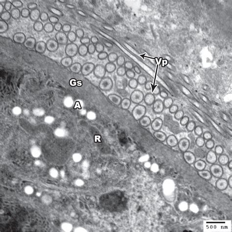 Tem Of S Cruzi Wall A Parasitophorous Vacuolar Membrane Pvm And
