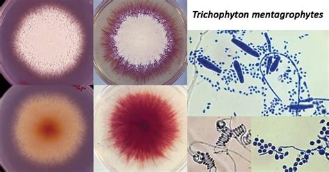 Trichophyton Spp An Overview Online Microbiology Notes