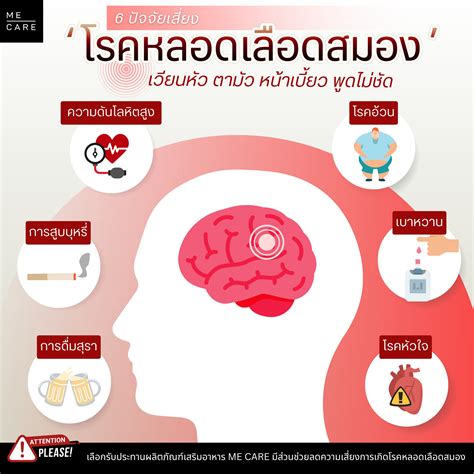 Me Care โรคหลอดเลือดสมอง Stroke หรือโรคอัมพฤกษ์ อัมพาต
